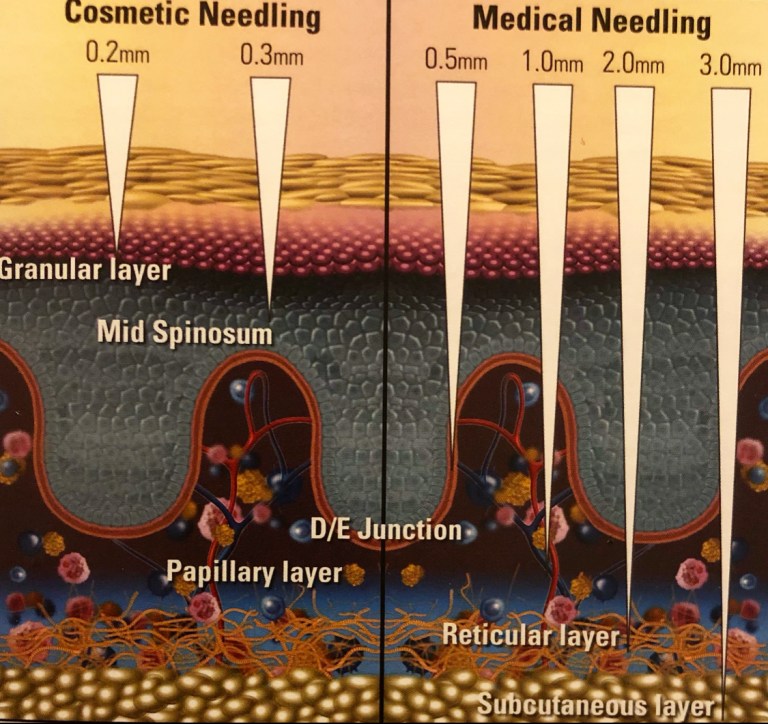 How Deep Should You Be Microneedling? – Skin Science by Mira