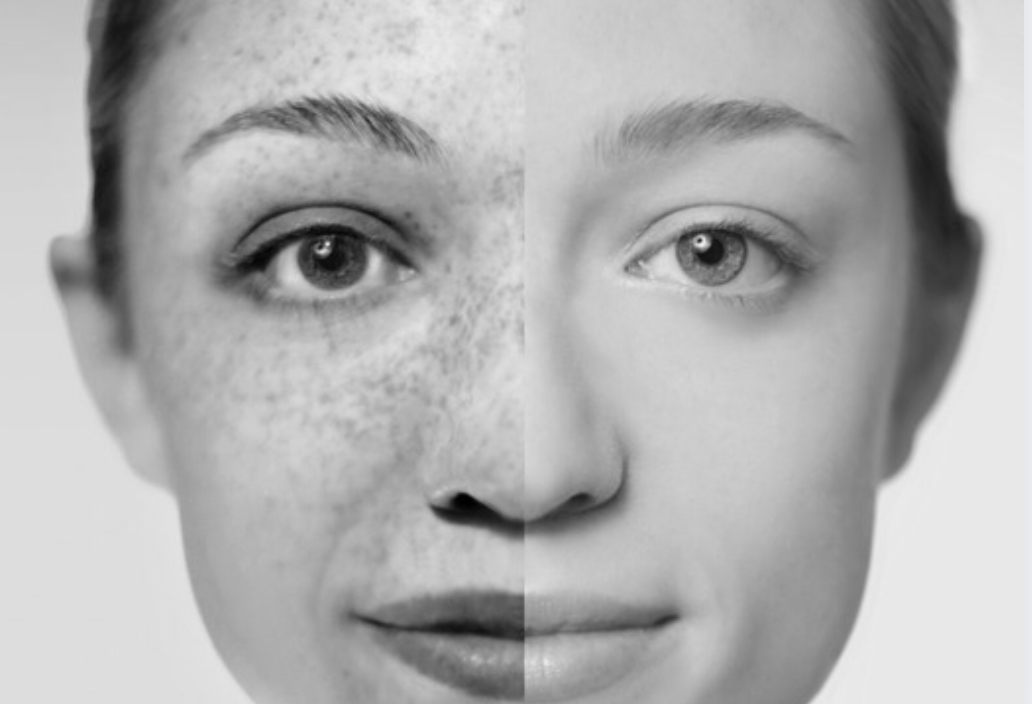 The Truth About Blue Light and Our Skin – Skin Science by Mira