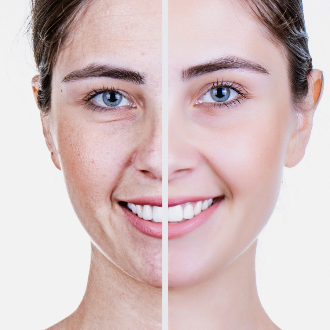 The Truth About Growth Factors – Skin Science by Mira